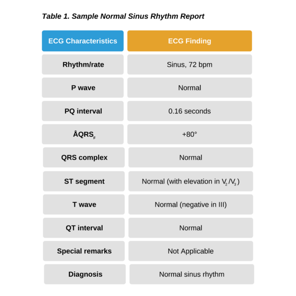 Topic - Definitive Electrocardiogram Diagnosis | 12-Lead ECG ...
