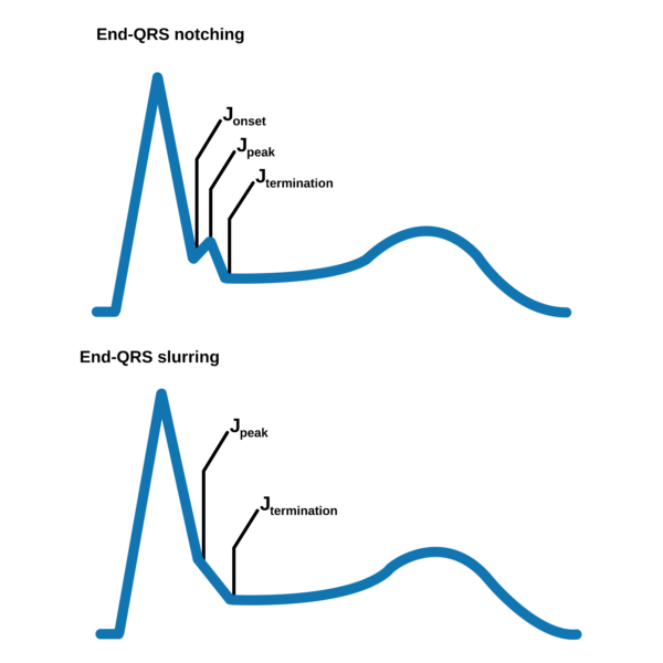 Topic - The QRS Complex | 12-Lead ECG Certification Course | ACLS ...