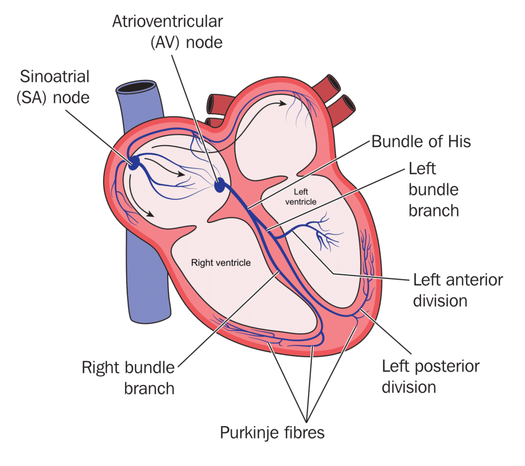 Chapter 30: Premature Ventricular Contractions | Monitor Tech ...