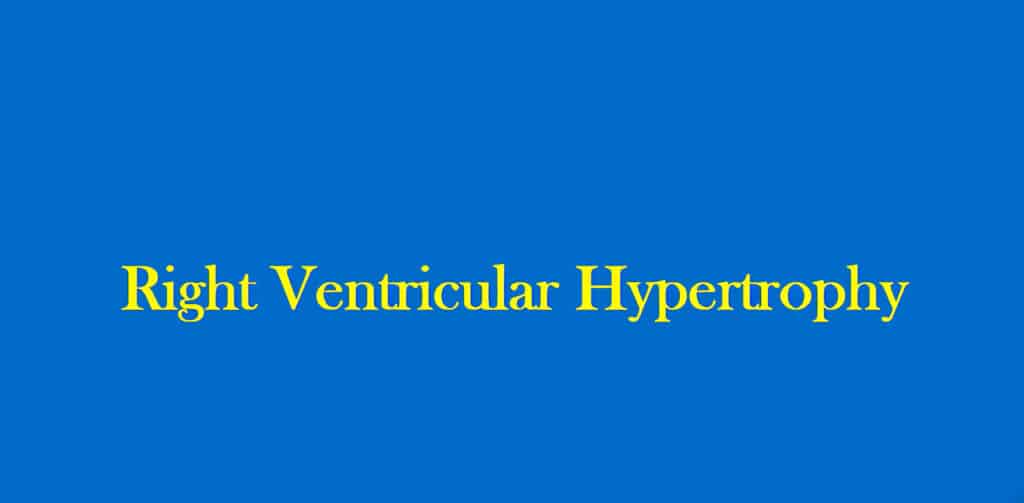 Topic - Electrocardiographic Findings | 12 Lead ECG Course | ACLS ...
