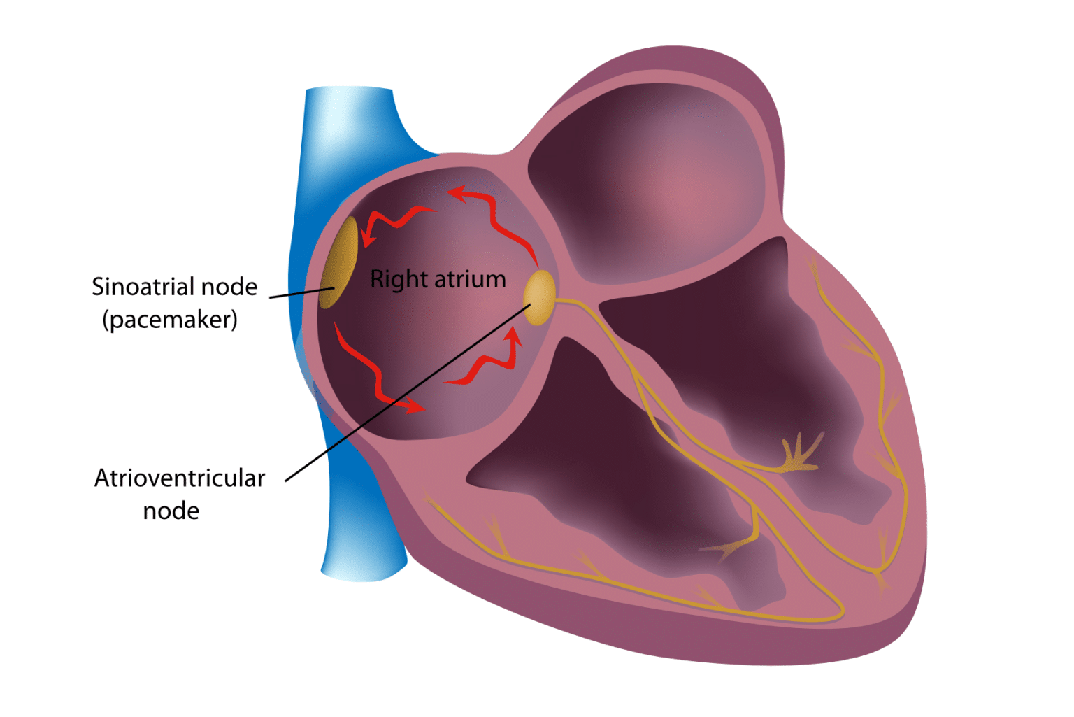 Topic Atrial Flutter 12 Lead Ecg Course Acls Certification Association