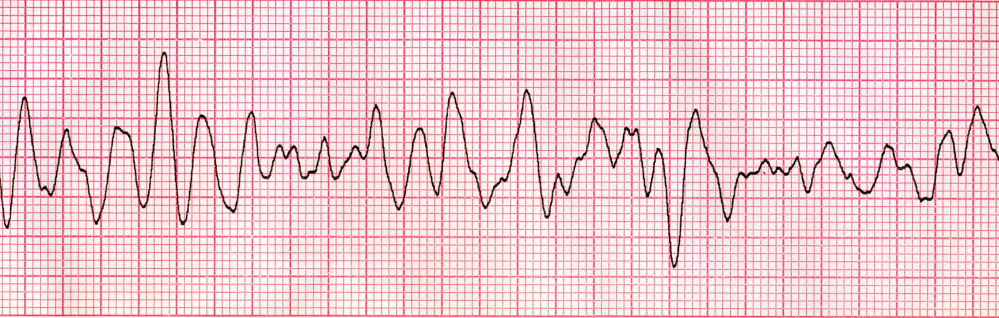 Topic - The PALS Cardiac Arrest Algorithm | PALS Course | ACLS ...
