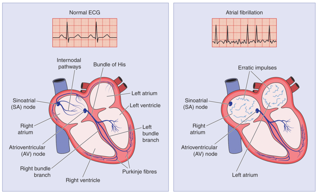 Topic - Diagnosing and Treating Tachycardias | ACLS EP Course | ACLS ...