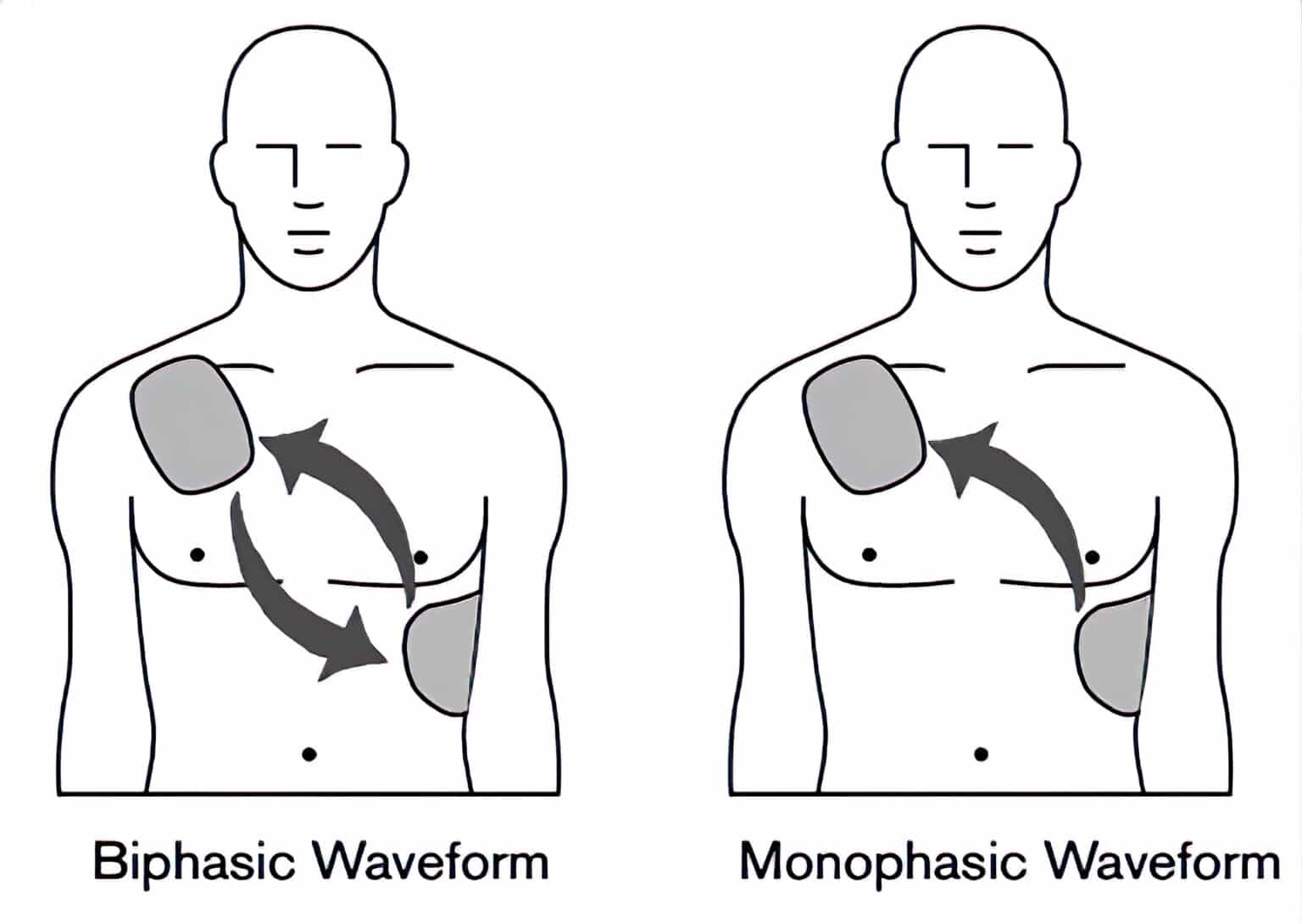Topic - Manual Defibrillation | ACLS EP Course | ACLS Certification ...