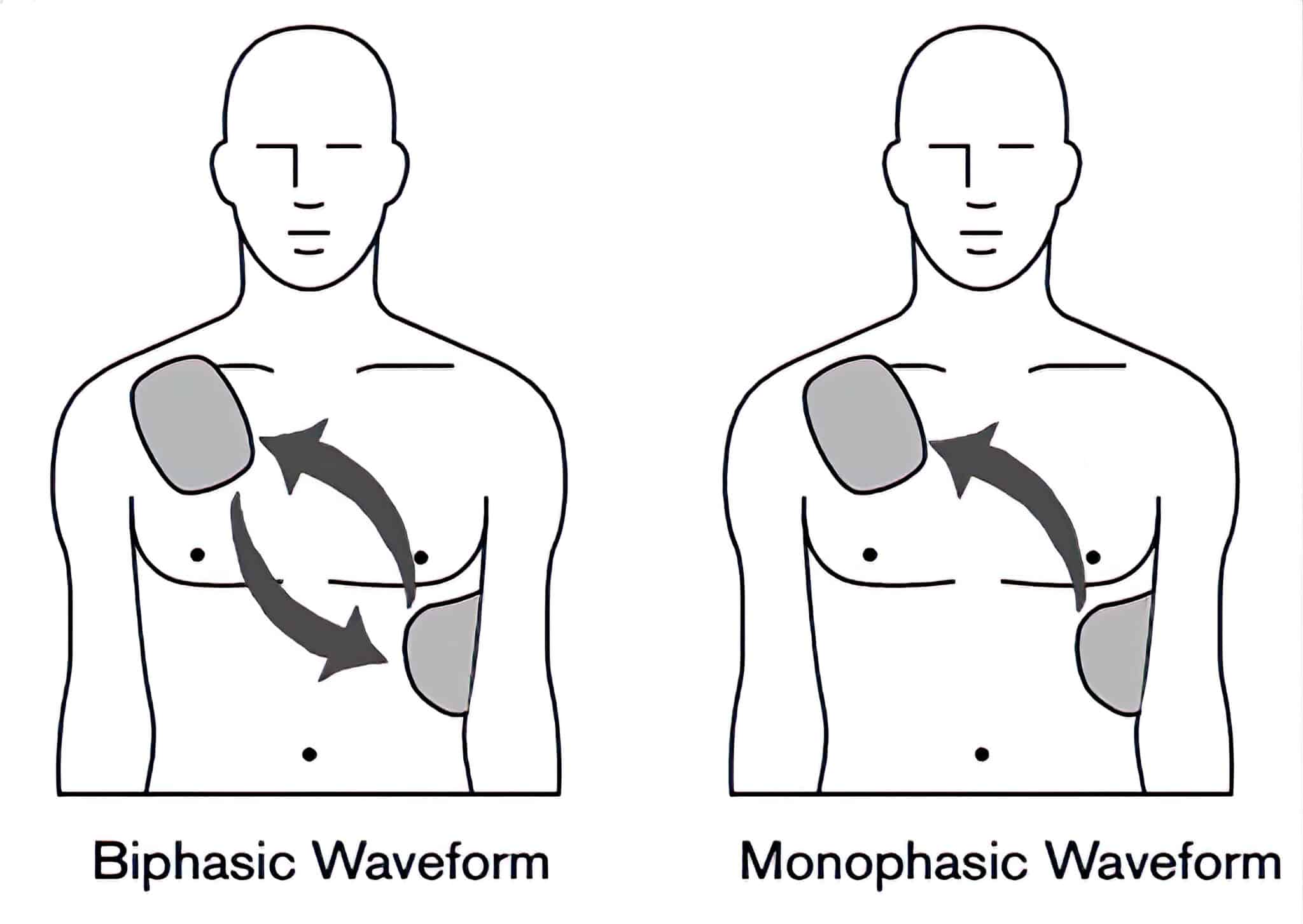 Topic - Manual Defibrillation | ACLS EP Course | ACLS Certification ...