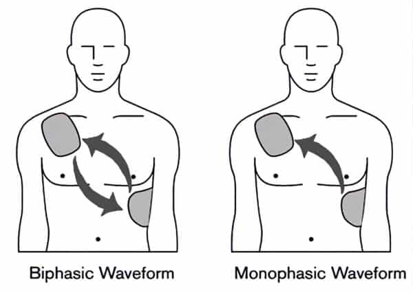 Topic - Manual Defibrillation | ACLS EP Course | ACLS Certification ...