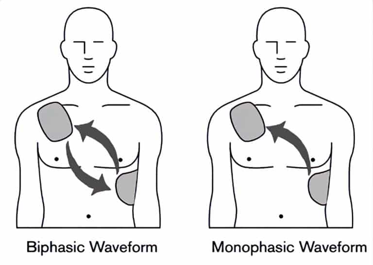 Topic - Manual Defibrillation | ACLS EP Course | ACLS Certification ...