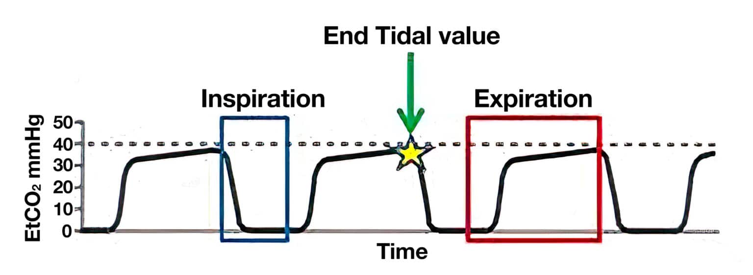Topic - Waveform Capnography | ACLS EP Course | ACLS Certification ...