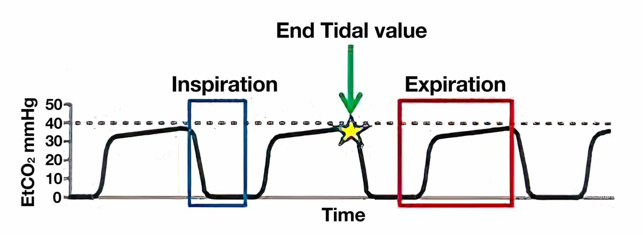 Topic - Waveform Capnography | ACLS EP Course | ACLS Certification ...