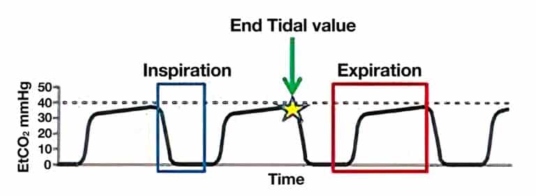 Topic - Waveform Capnography | ACLS EP Course | ACLS Certification ...