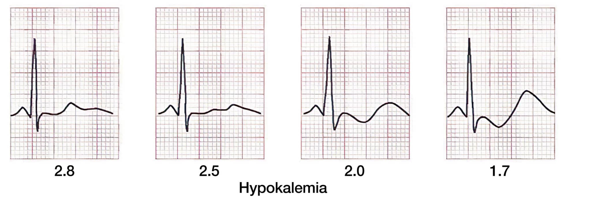 Topic - Potassium | ACLS EP Course | ACLS Certification Association