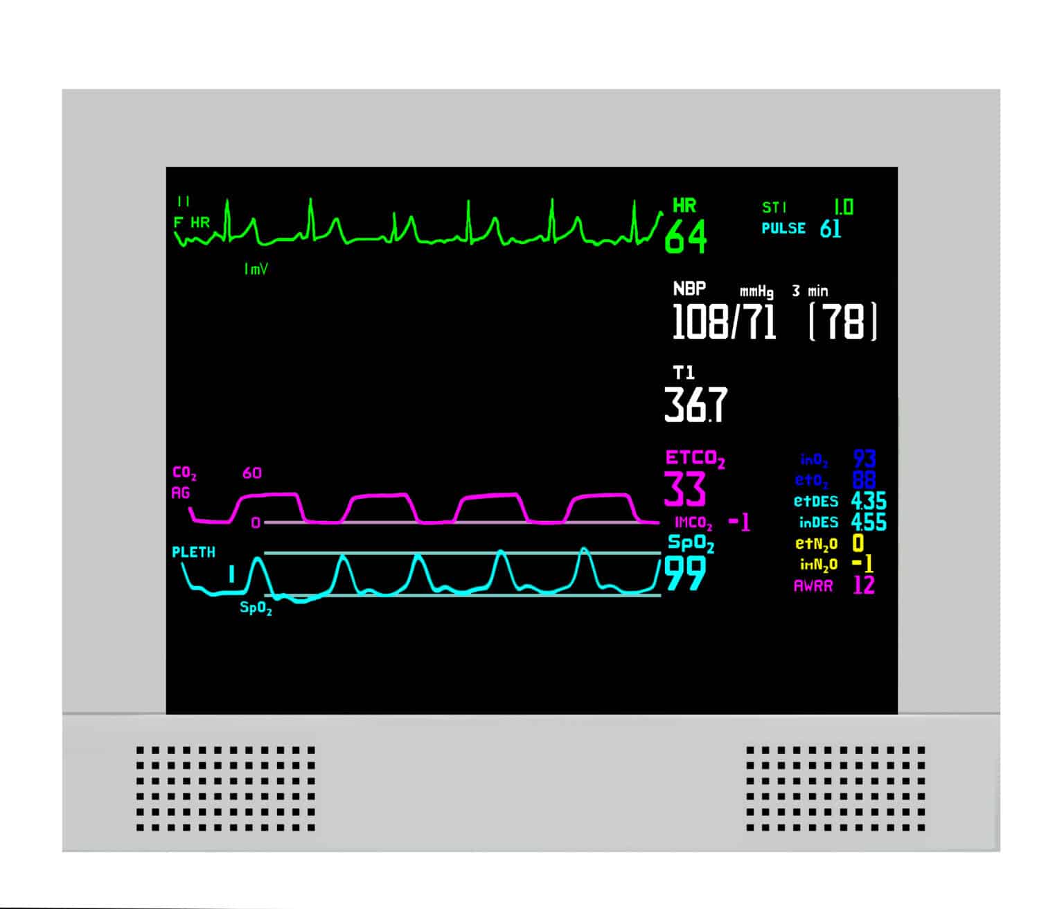 Topic - Waveform Capnography | ACLS EP Course | ACLS Certification ...