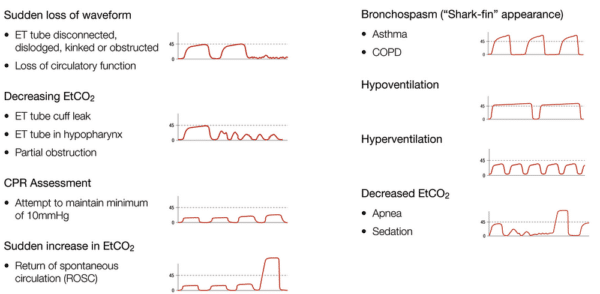 Topic - Monitoring the Patient during CPR | ACLS EP Course | ACLS ...