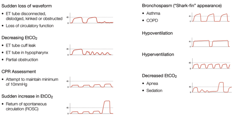 Topic - Monitoring the Patient during CPR | ACLS EP Course | ACLS ...