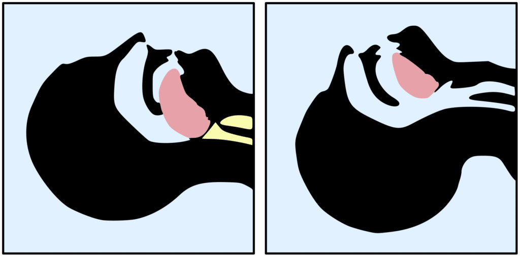 Topic - CPR and AED Use for Adults | First Aid - CPR - AED Course ...