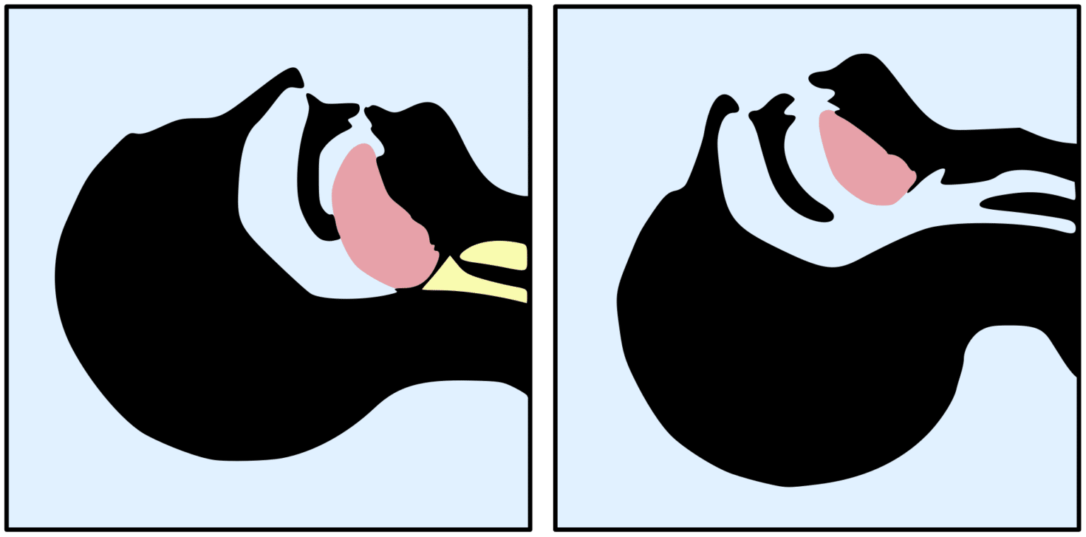 Topic - CPR and AED Use for Adults | First Aid - CPR - AED Course ...