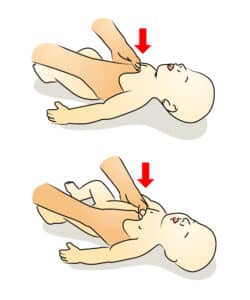 Topic - Evaluating Positive pressure Ventilation | Neonatal ...