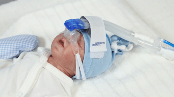 Topic - Ventilating the Preterm Newborn | Neonatal Resuscitation Course ...