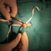 Topic - Umbilical Venous Catheterization | NRP Course | ACLS ...