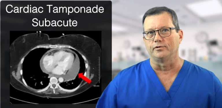 Cardiac Tamponade | ACLS Resources | ACLS Certification Association