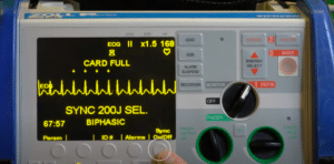 Synchronized Cardioversion | ACLS Resources | ACLS Certification ...