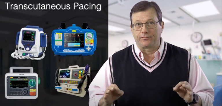Transcutaneous Pacing | ACLS Resources | ACLS Certification Association