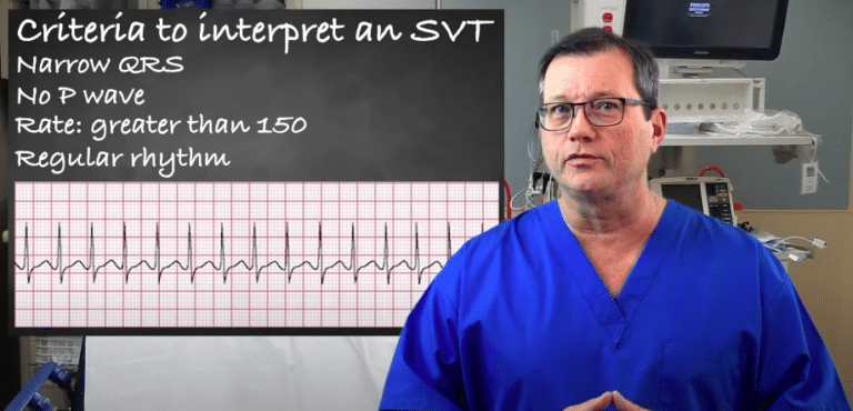 Criteria for a SVT | 12-Lead ECG Resources | ACLS Certification Association