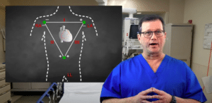 Einthoven’s Triangle Explained: ECG Leads I, II & III