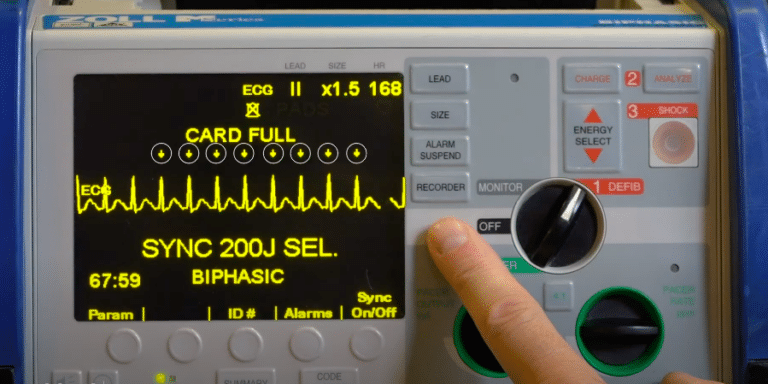Synchronized Cardioversion: ACLS Indications & Steps