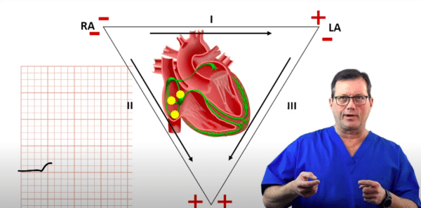 Einthoven’s Triangle Explained: ECG Leads I, II & III