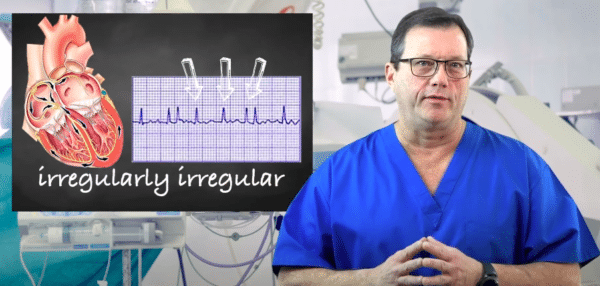 Criteria to Determine Atrial Fibrillation | 12-Lead ECG Resources ...