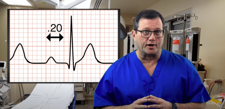 First-Degree Heart Block Criteria | 12-Lead ECG Resources | ACLS ...