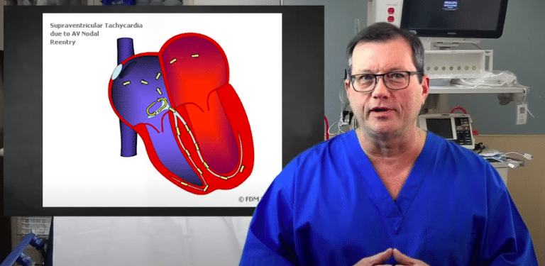 SVT ECG Criteria: Rate, Rhythm, P Waves & QRS Width