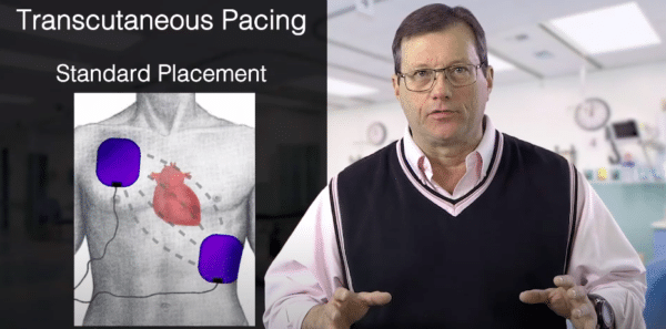 Transcutaneous Pacing | ACLS Resources | ACLS Certification Association
