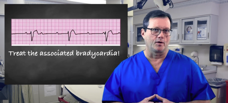 Third-Degree Complete Heart Block | 12-Lead ECG Resources | ACLS ...