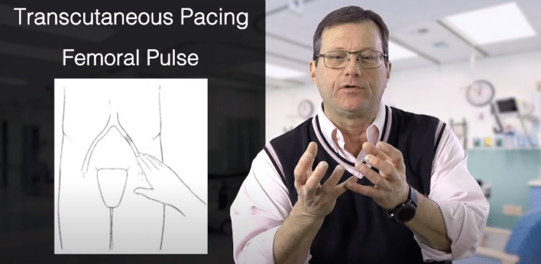 Transcutaneous Pacing | ACLS Resources | ACLS Certification Association