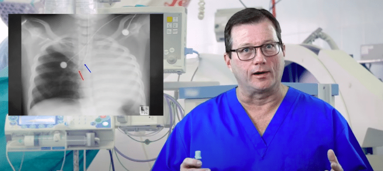 Fixing Right Mainstem Intubation | ACLS Resources | ACLS Certification ...